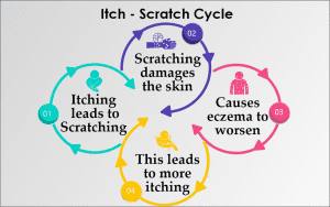 Reducing eczema flares using scratch control techniques | Eczemaless