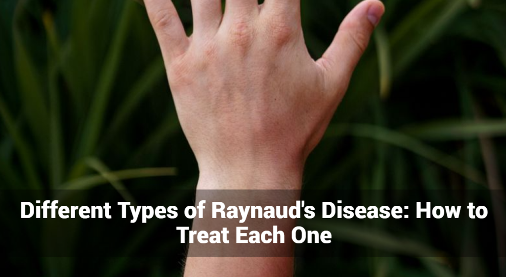 Different Types of Raynaud’s Disease: How to Treat Each One | Eczemaless