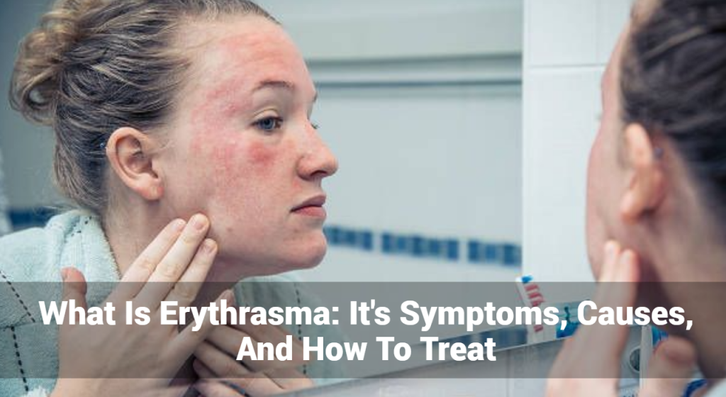 What Is Erythrasma: It’s Symptoms, Causes, And How To Treat | Eczemaless